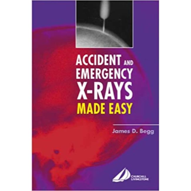 Accident and Emergency X-Rays Made Easy International Edition, BY J. B ...